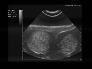 Ultrazvučni pregled testisa (skrotuma) i adneksa 3.500,00 RSD - Dr ...